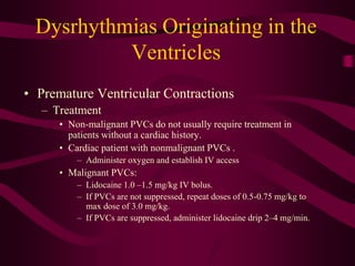 Ventricular and paced arrhythmias | PPTX