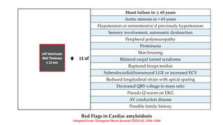 Ventricular Arrhythmias in Cardiac Amyloidosis.pdf