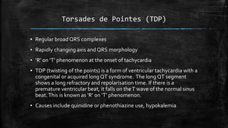 Ventricular arryhythmias | PPTX