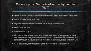 Ventricular arryhythmias | PPT