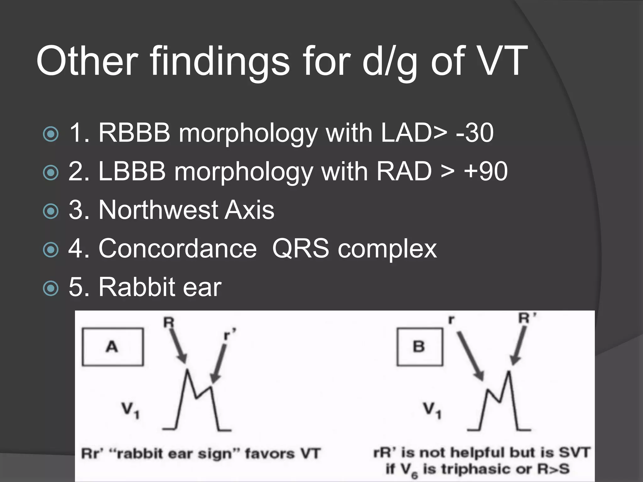 Ventricular arrythmia | PPTX