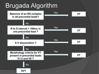 Ventricular arrythmia | PPTX