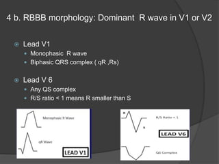 Ventricular arrythmia | PPTX