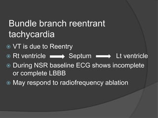 Ventricular arrythmia | PPTX