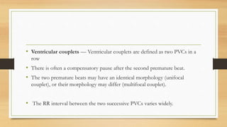 Ventricular arrythmia | PPTX
