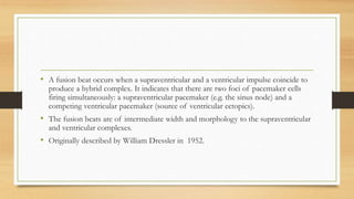 Ventricular arrythmia | PPTX