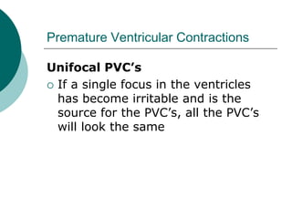 VENTRICULAR ARYTHMIAS.ppt