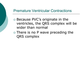 VENTRICULAR ARYTHMIAS.ppt