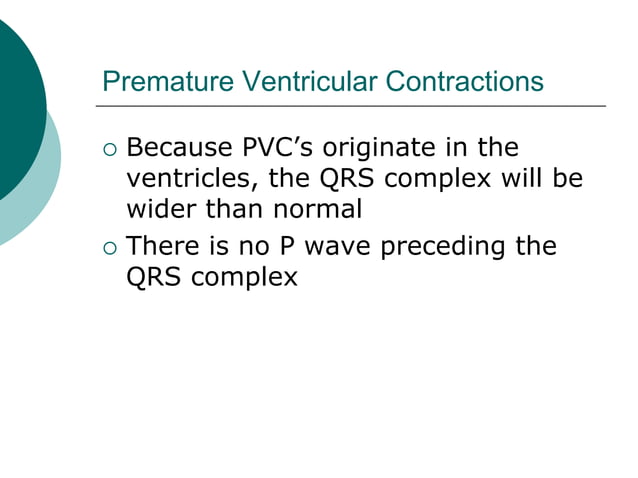 VENTRICULAR ARYTHMIAS.ppt