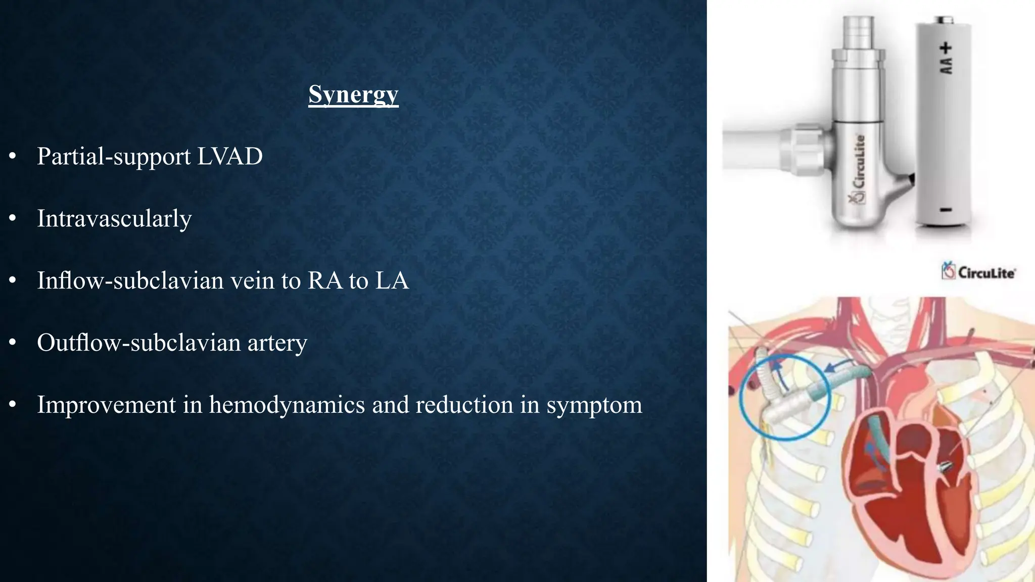 Ventricular assist devices history and recent advances | PPT