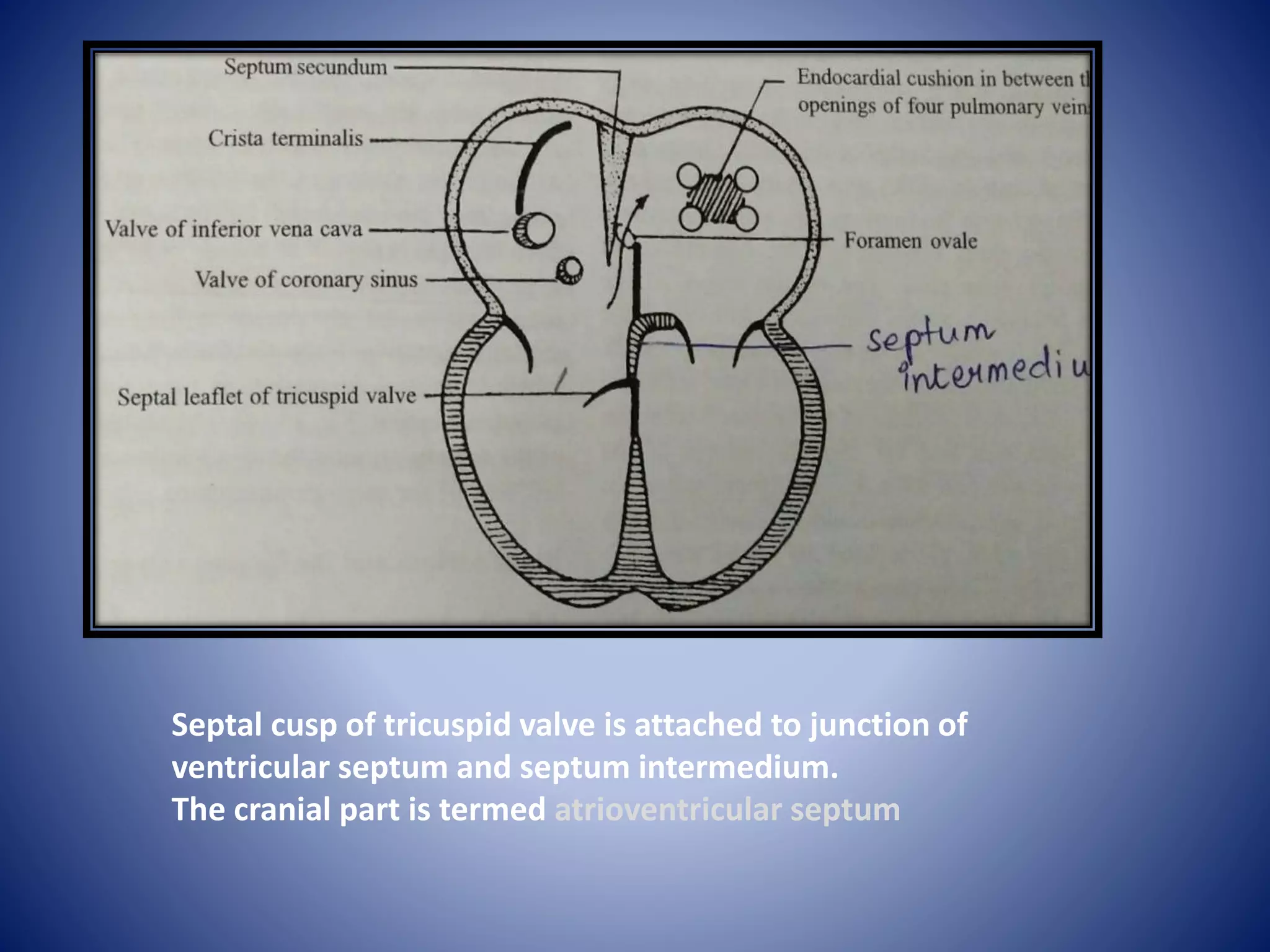 Ventricular development | PPTX | Heart and Cardiovascular Diseases ...