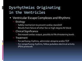 Ventricular dysrhythmias | PPTX