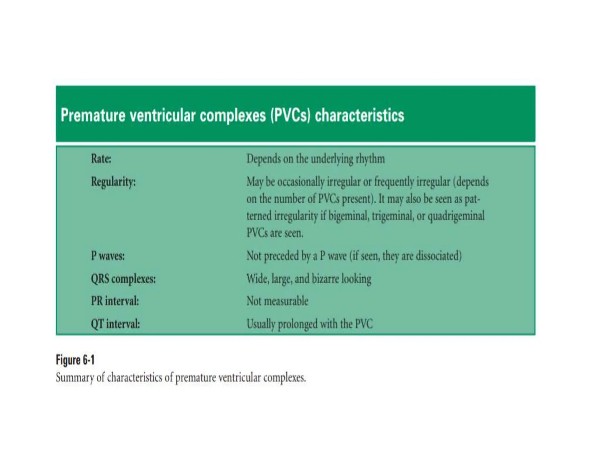 VENTRICULAR DYSRHYTHMIAS AND HOW TO INTERPRET IN ECG? | PPT