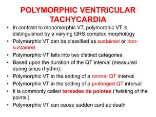 VENTRICULAR DYSRHYTHMIAS AND HOW TO INTERPRET IN ECG? | PPT
