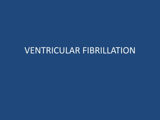 Ventricular Fibrillation