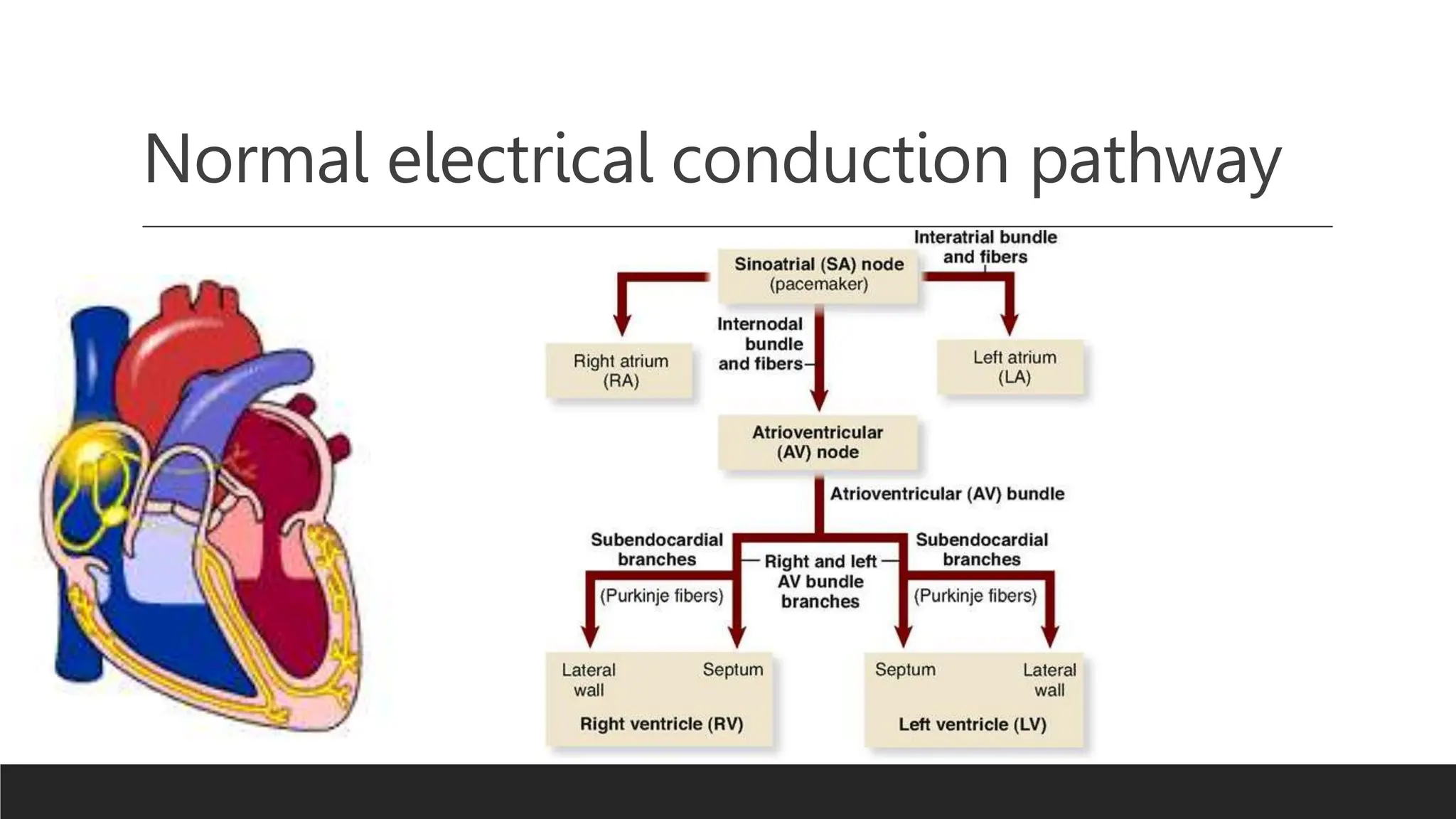 Ventricular preexcitation syndrome.pptx
