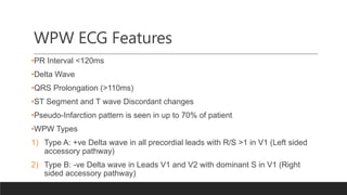 Ventricular preexcitation syndrome.pptx