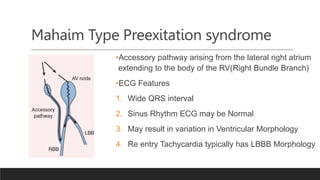 Ventricular preexcitation syndrome.pptx