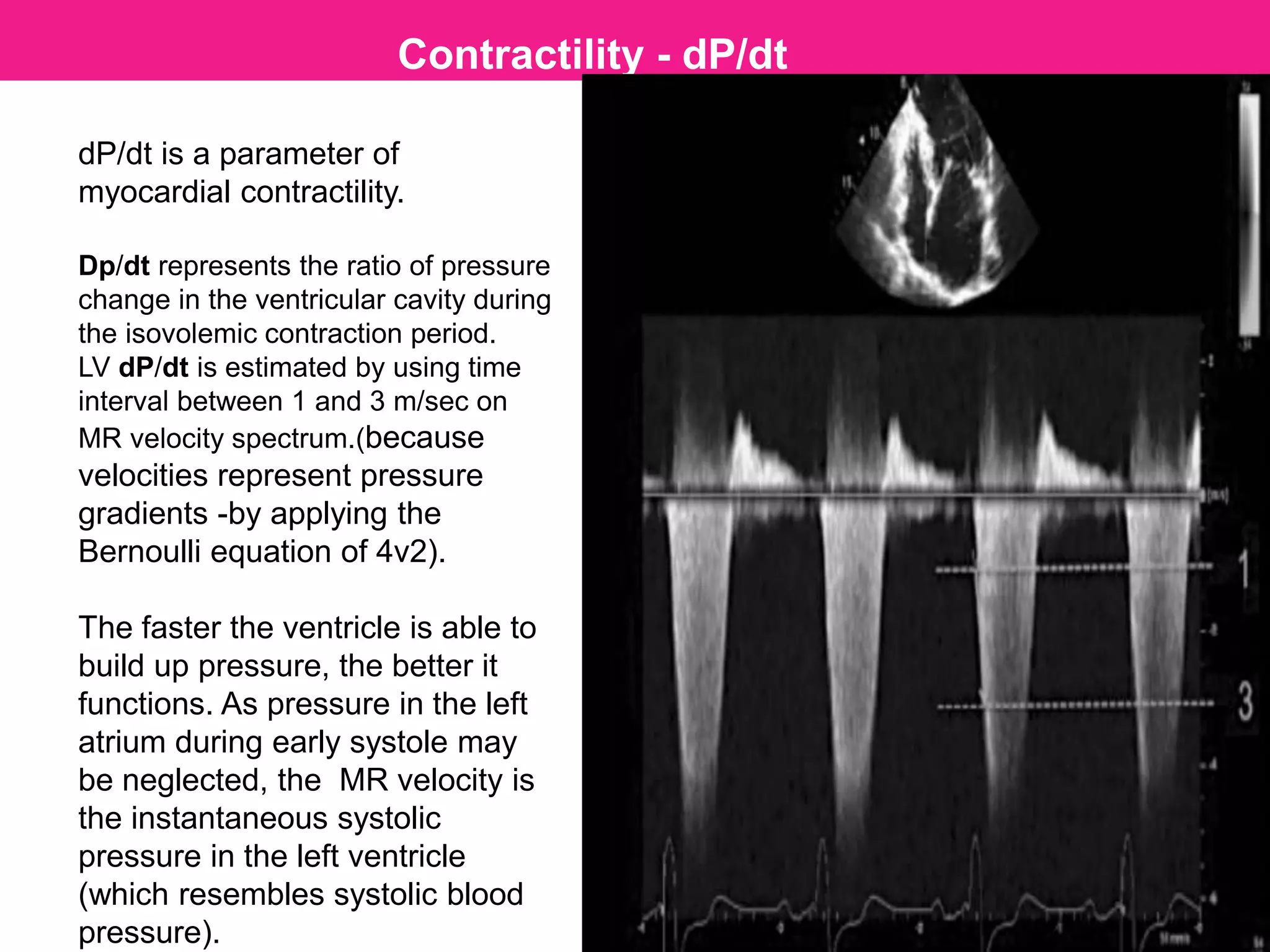 Ventricular PV loop 2019 | PPTX