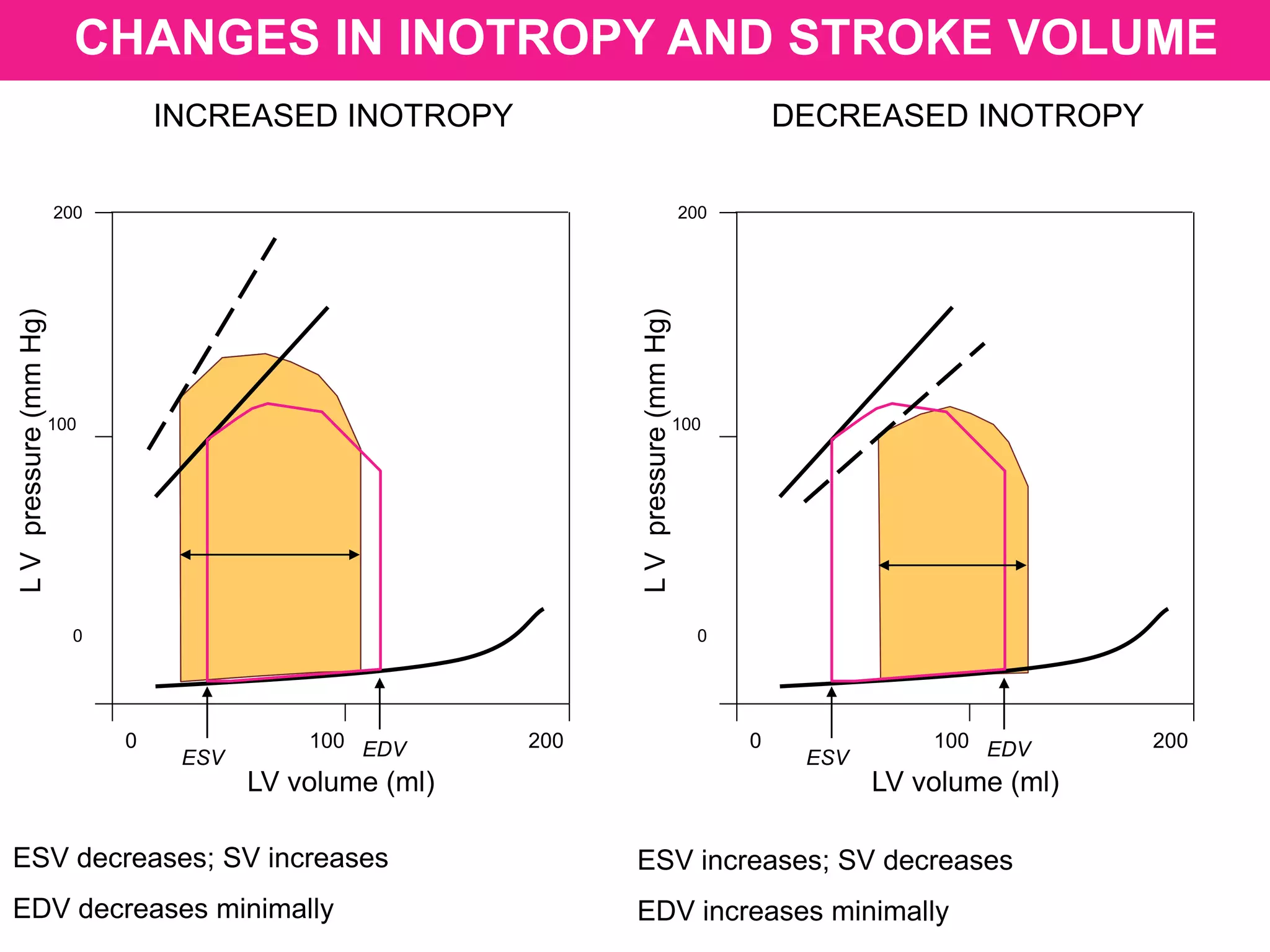 Ventricular PV loop 2019 | PPTX