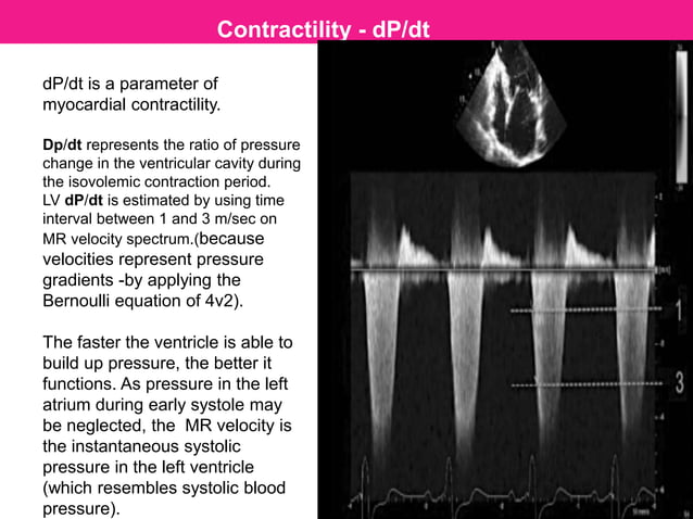 Ventricular PV loop 2019 | PPTX | Heart and Cardiovascular Diseases ...