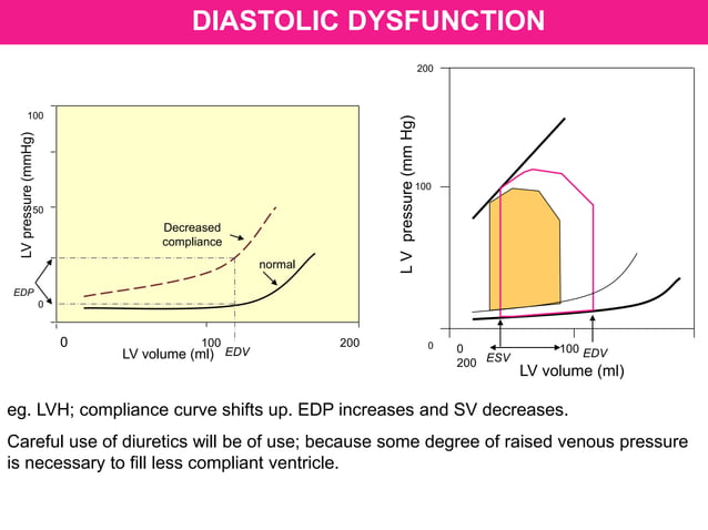 Ventricular PV loop 2019 | PPTX | Heart and Cardiovascular Diseases ...