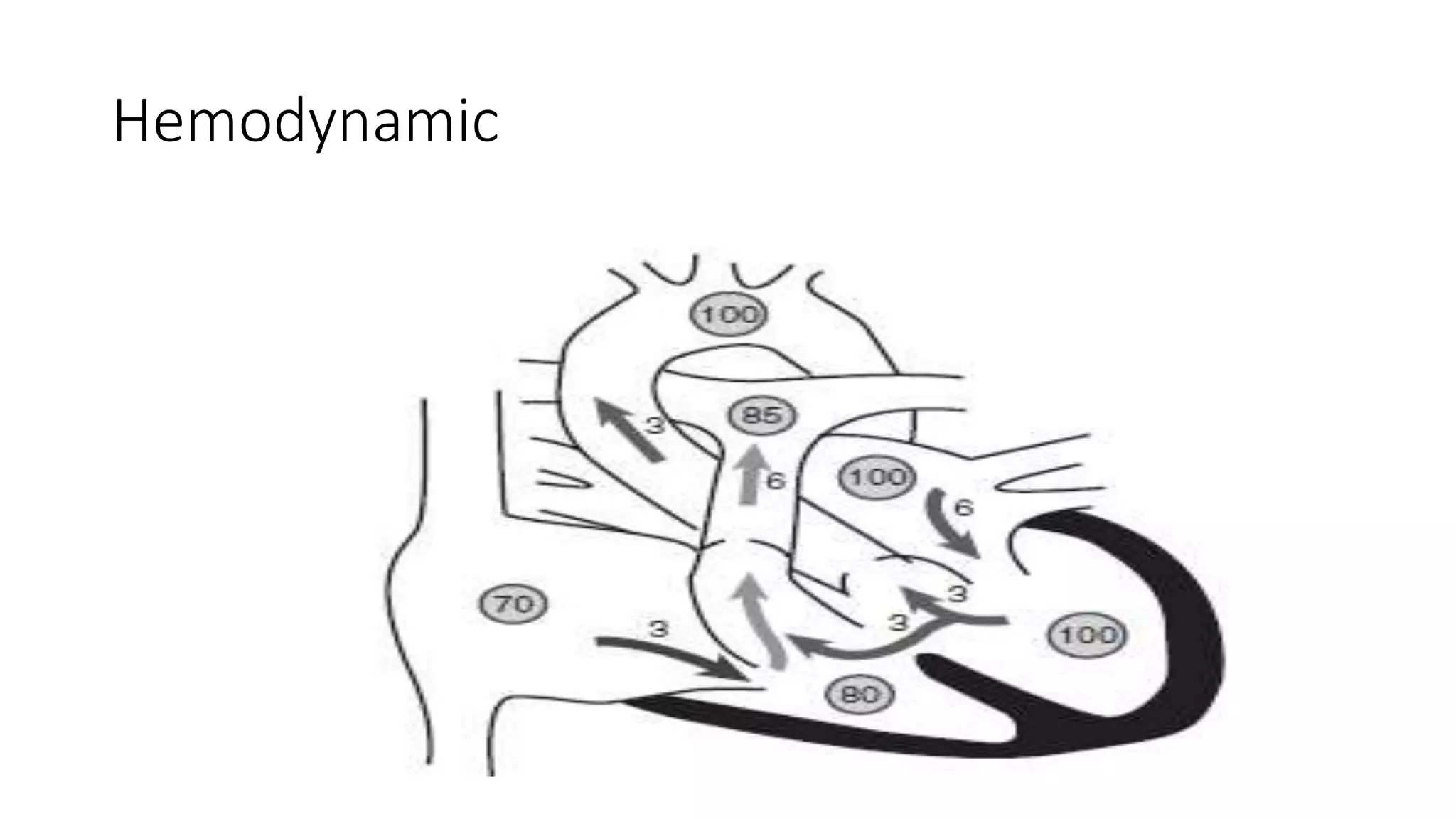 Ventricular Septal Defect Ppt