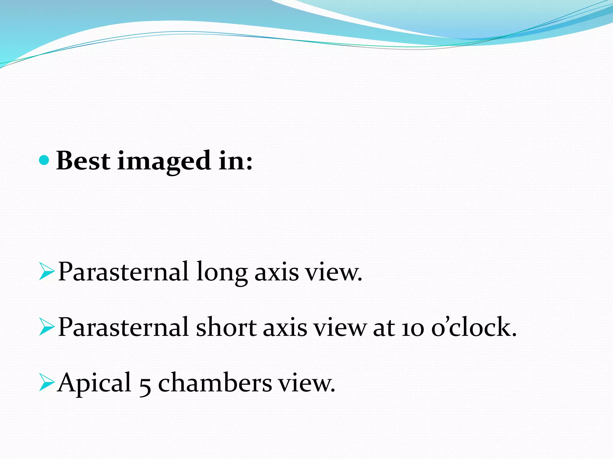 Ventricular Septal Defect Ppt