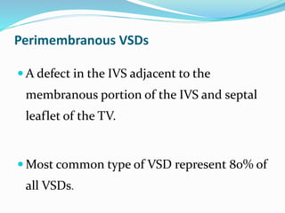 Ventricular septal defect | PPTX