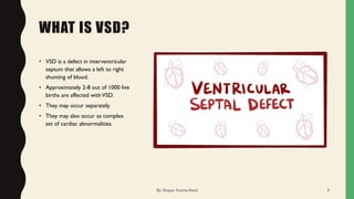 Ventricular septal defect | PDF