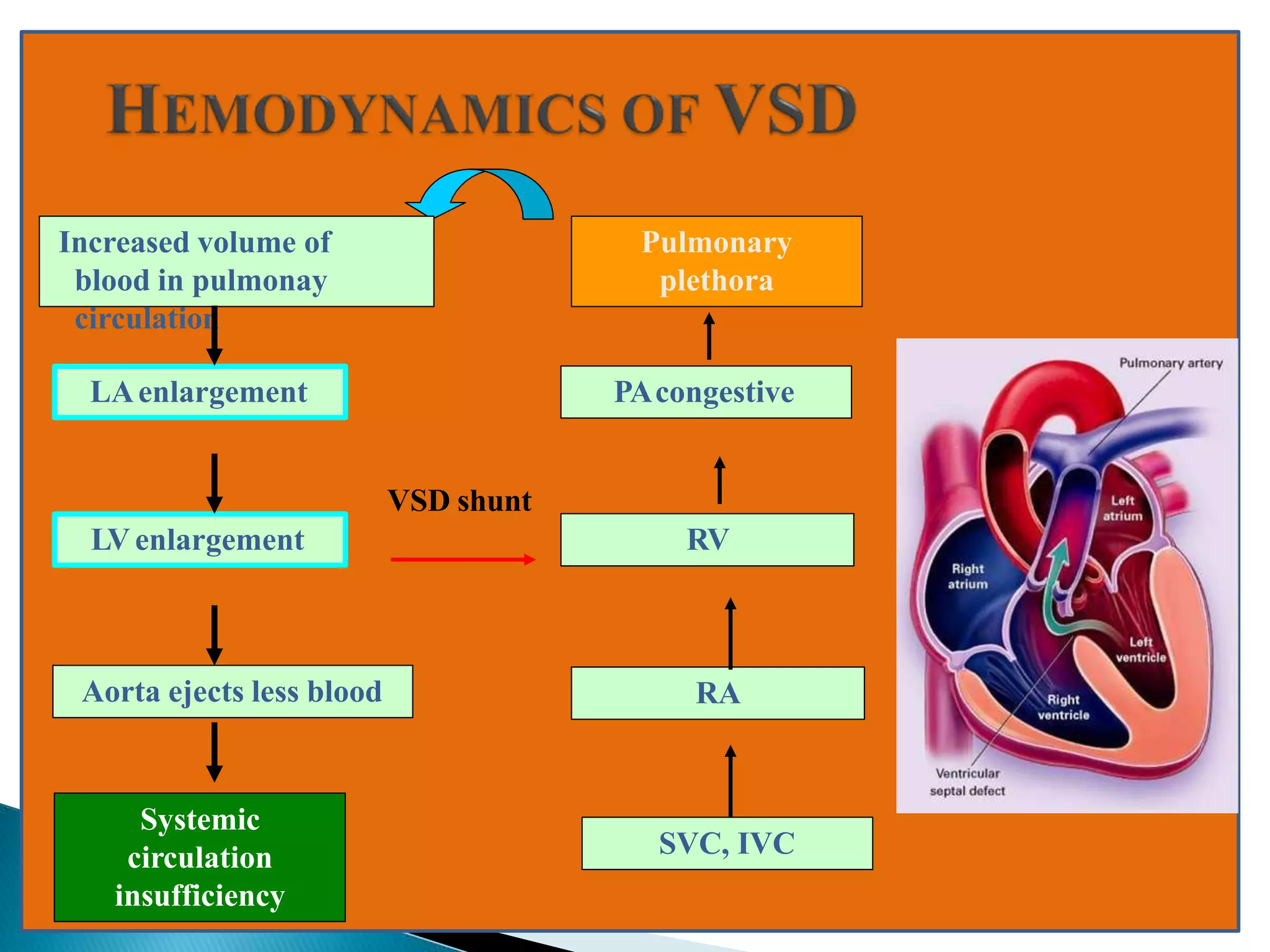 Ventricular Septal Defect Ppt
