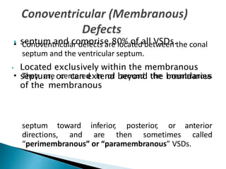 Ventricular septal defect | PPTX