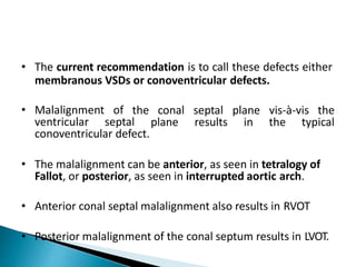 Ventricular septal defect | PPTX
