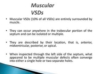 Ventricular septal defect | PPTX