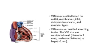 Ventricular septal defect | PPTX