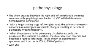 Ventricular septal defect | PPTX