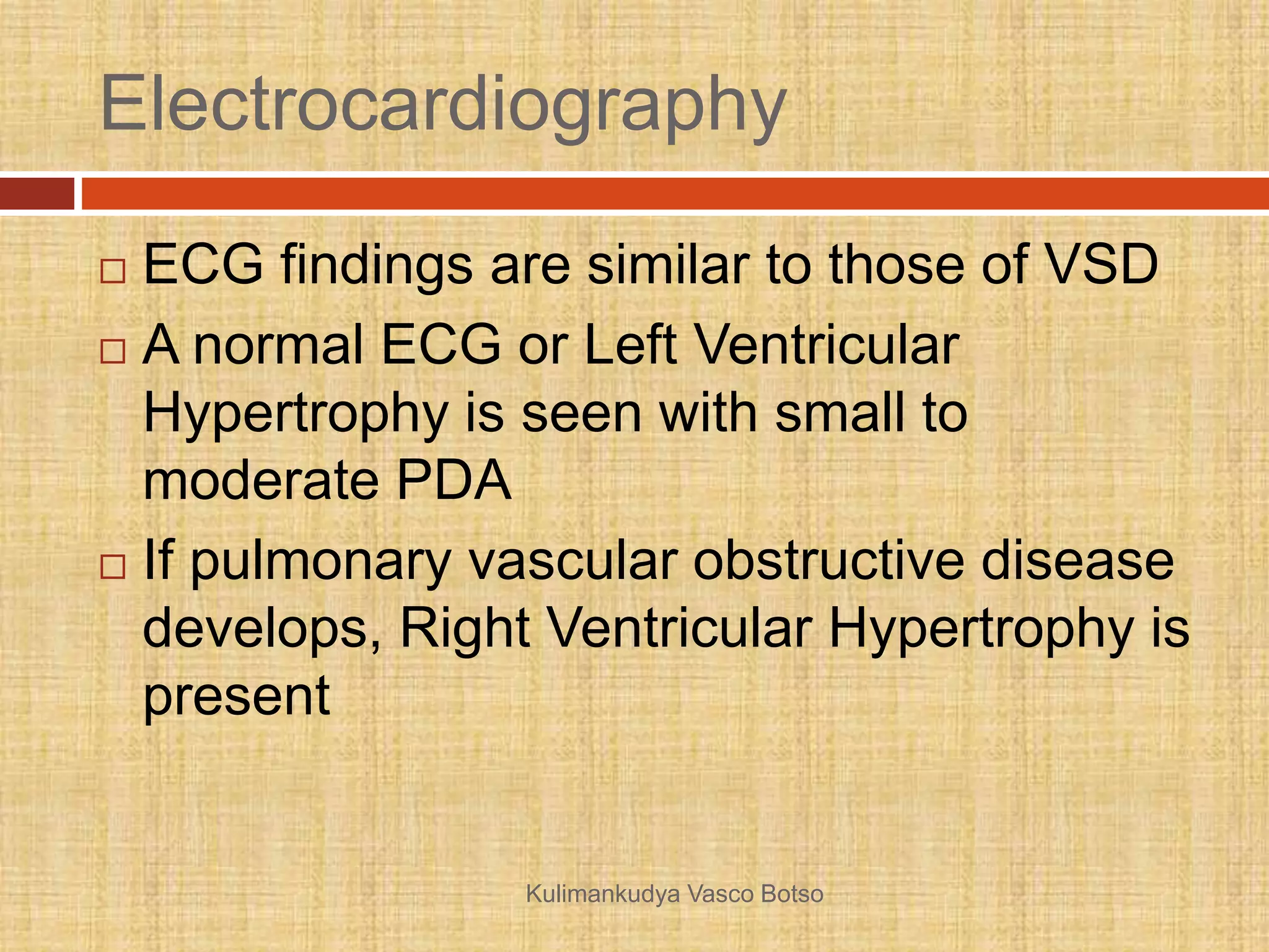 Ventricular Septal Defect Ppt
