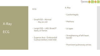 Ventricular septal defect | PPT
