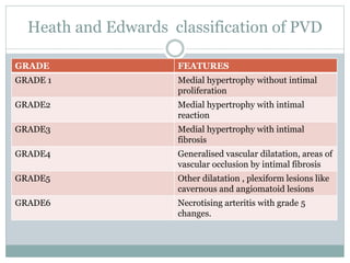 Ventricular septal defects | PPTX