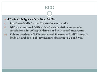 Ventricular septal defects | PPTX