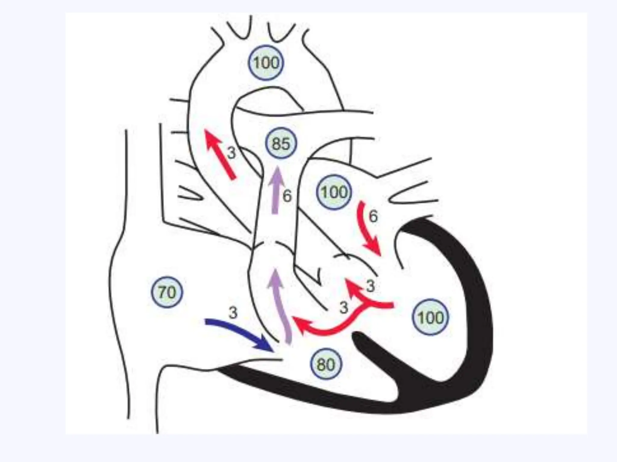 Imaging of Ventricular Septal Defects.ppt