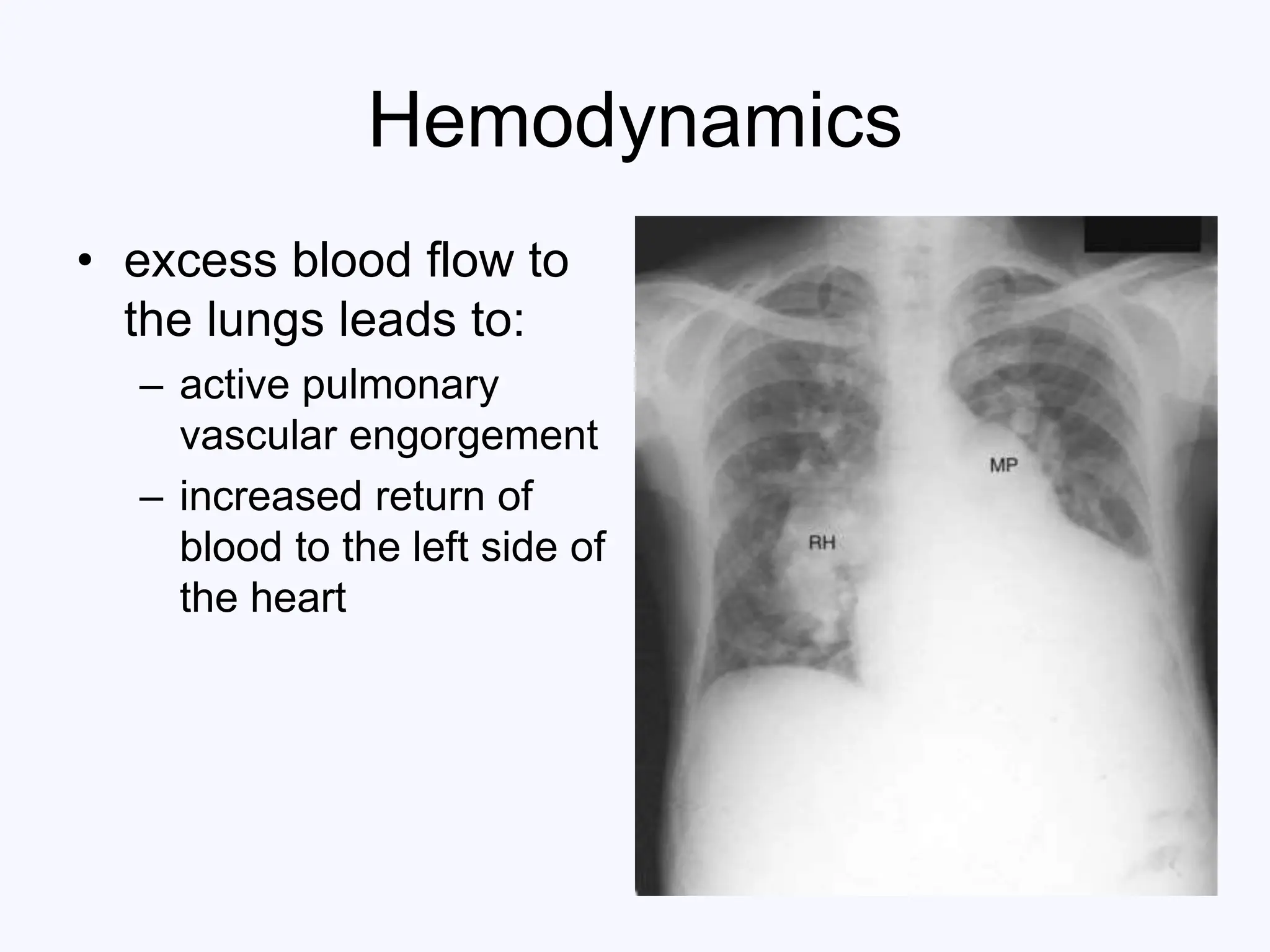 Imaging of Ventricular Septal Defects.ppt