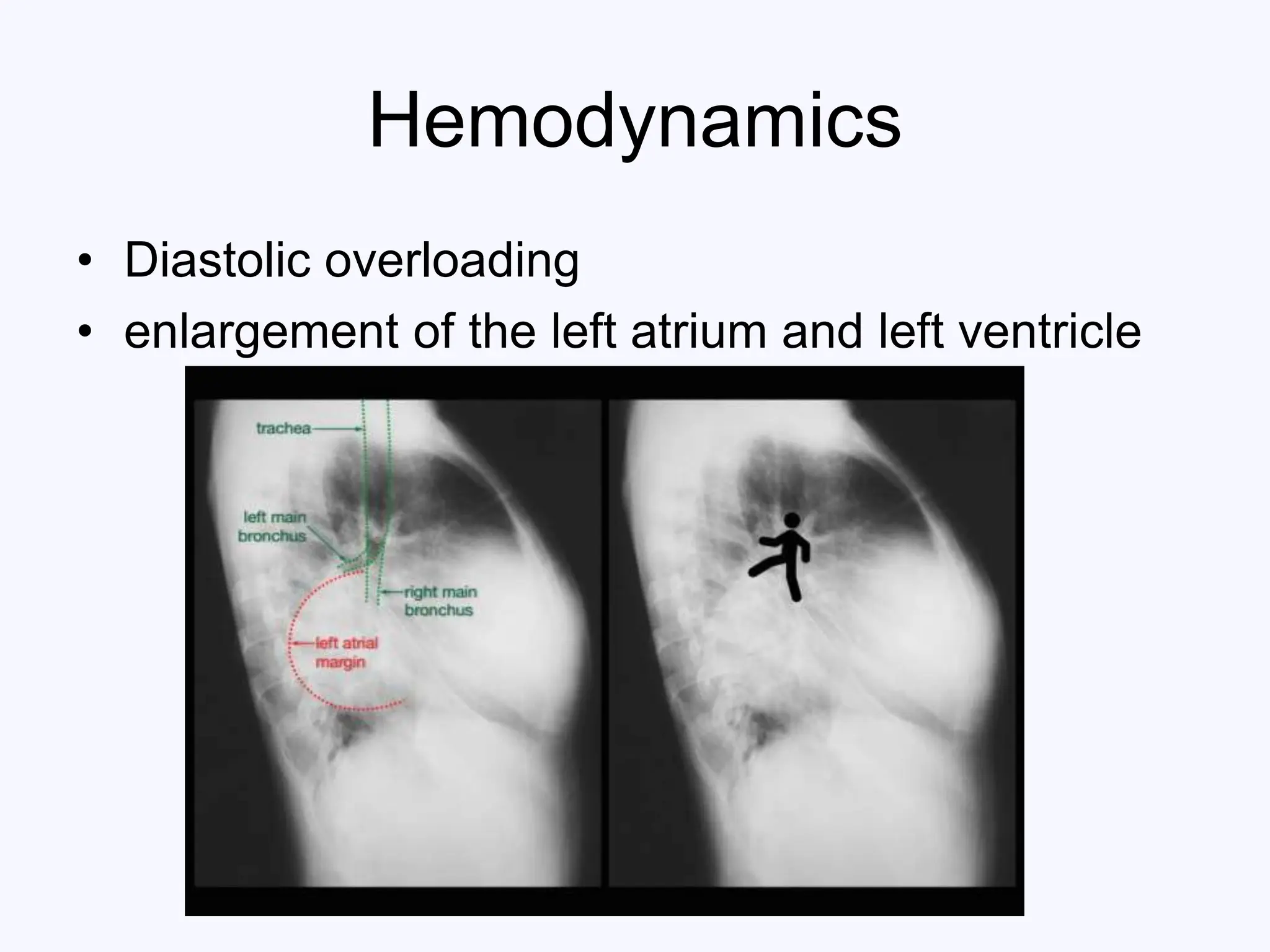 Imaging of Ventricular Septal Defects.ppt