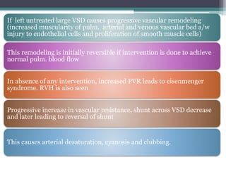 Ventricular septal defect (vsd) | PPTX