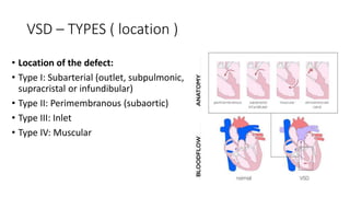 Ventricular septal defect (vsd) | PPT