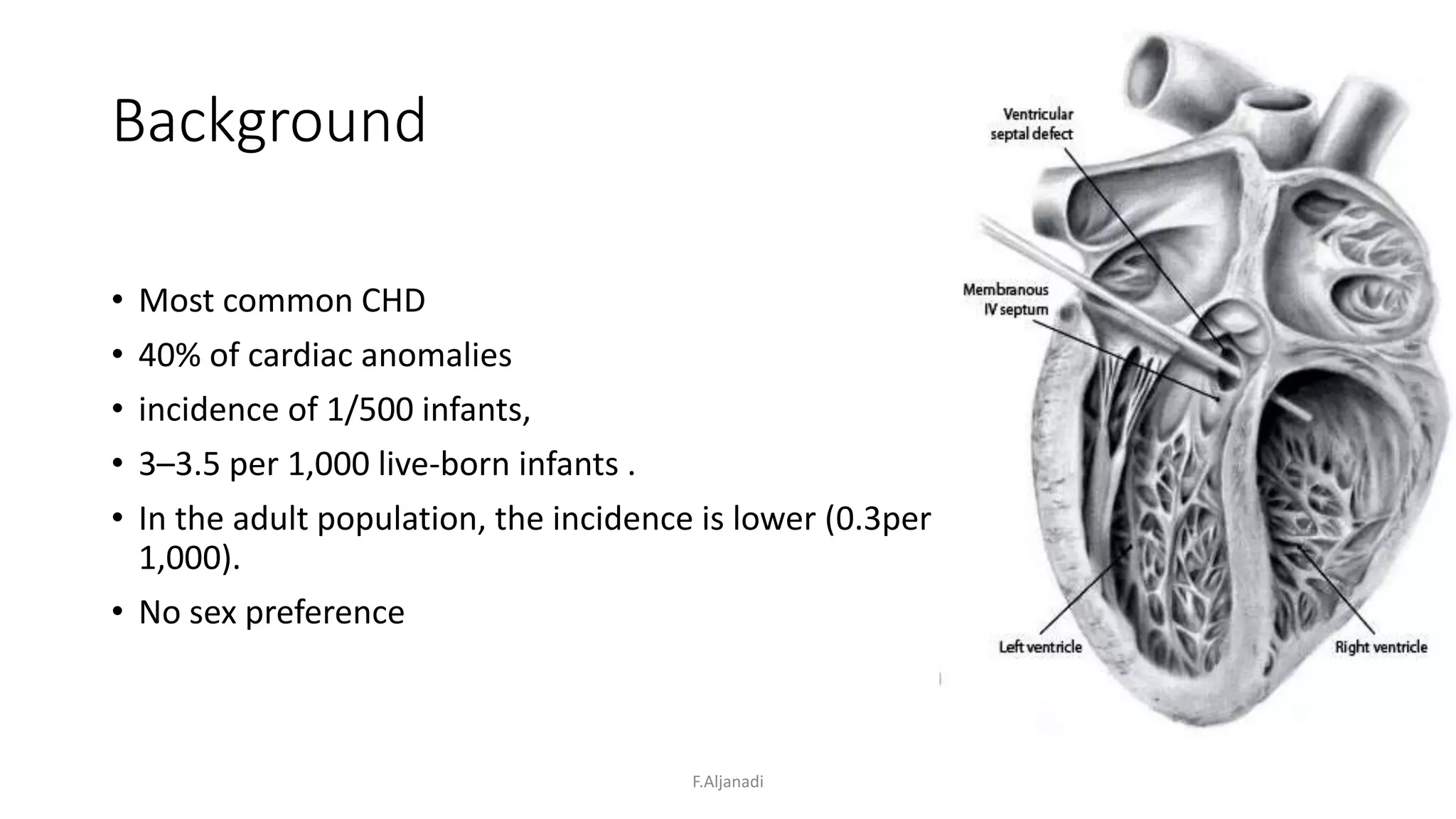 Ventricular septal defect VSD | PPT