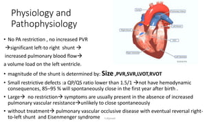 Ventricular septal defect VSD | PPTX