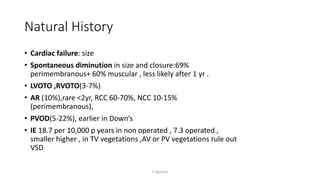 Ventricular septal defect VSD | PPTX