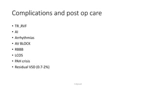 Ventricular septal defect VSD | PPT
