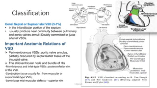 Ventricular septal defect VSD | PPT